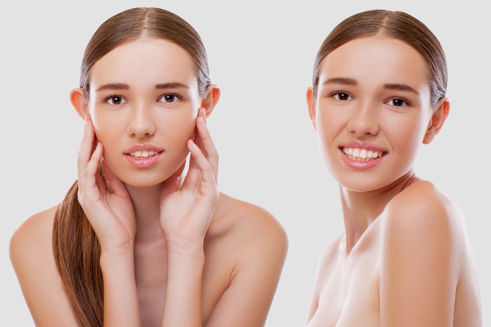 Otoplastika - operace odstátých uší - TOPZINE.cz